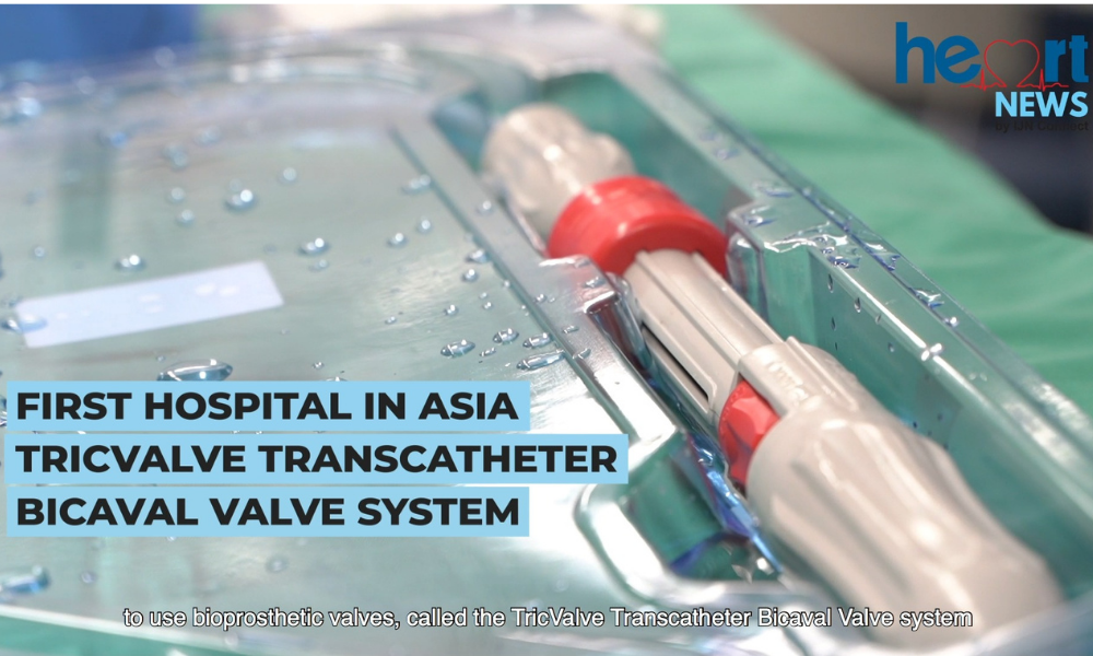 IJN first in Asia to carry out innovative heart valve treatment